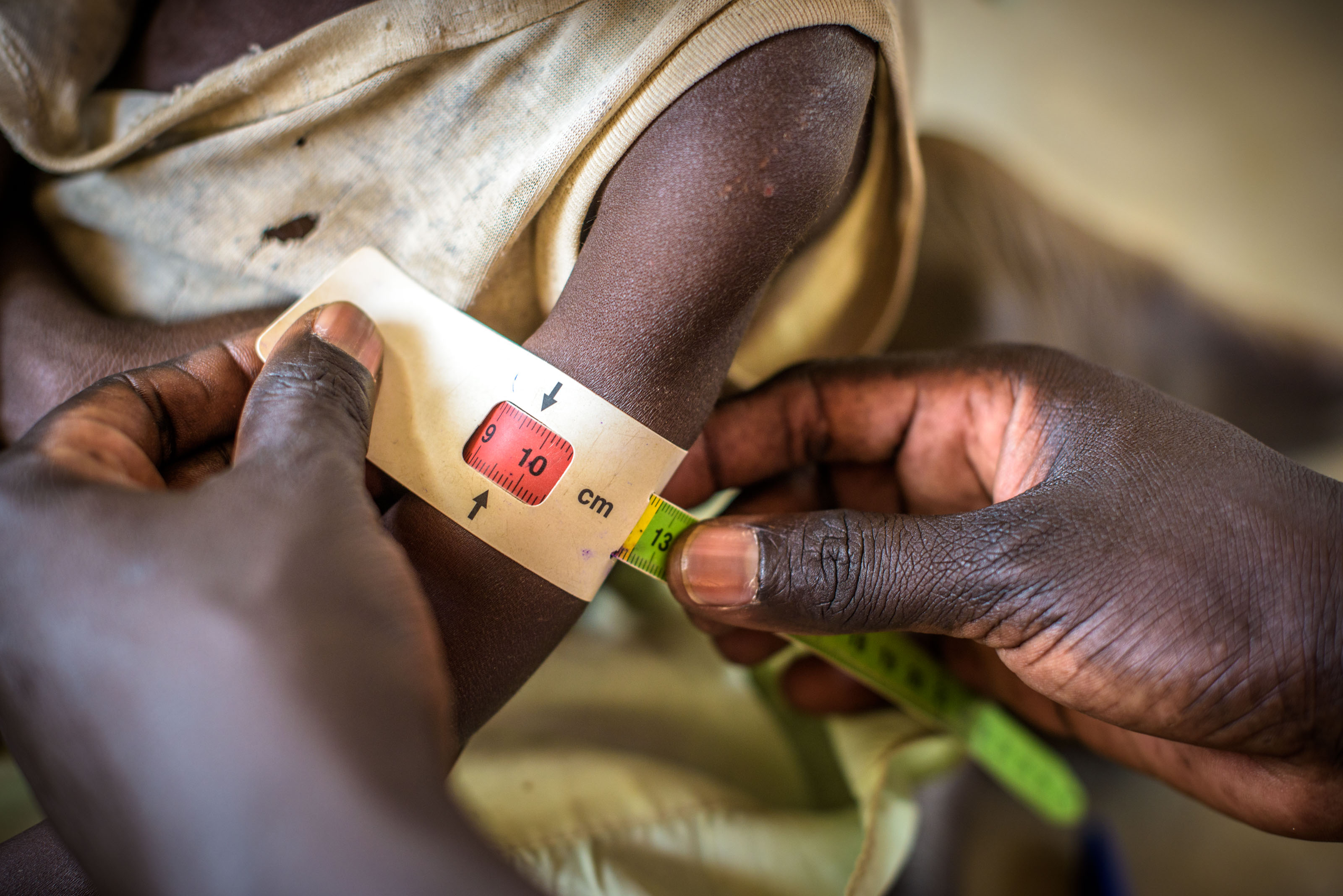 Hungersnot in Afrika bedroht das... Aktion Deutschland Hilft